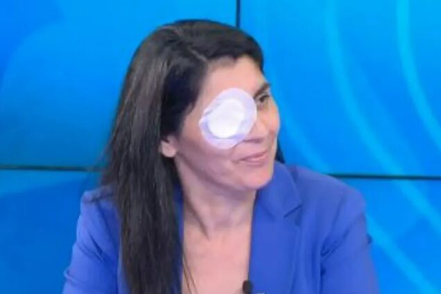 Μεσσήνη: «Ούρλιαζα, καιγόμουν» περιγράφει η 49χρονη που δέχθηκε επίθεση ...