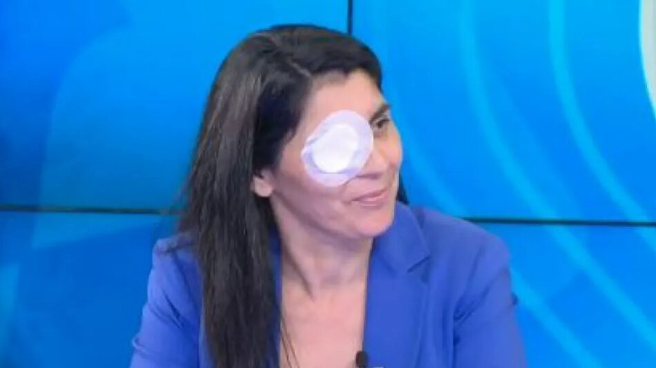 Μεσσήνη: «Ούρλιαζα, καιγόμουν» περιγράφει η 49χρονη που δέχθηκε επίθεση ...